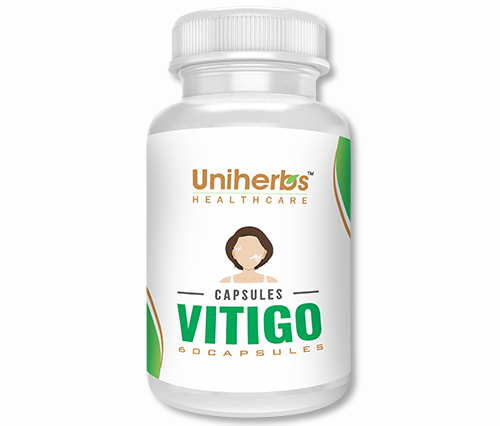 Vitigo Capsules for 60 Cap – uniherbsindia