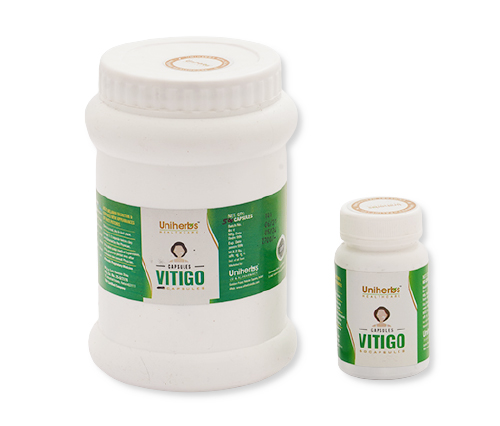 Vitigo Capsules for 60 Cap – uniherbsindia